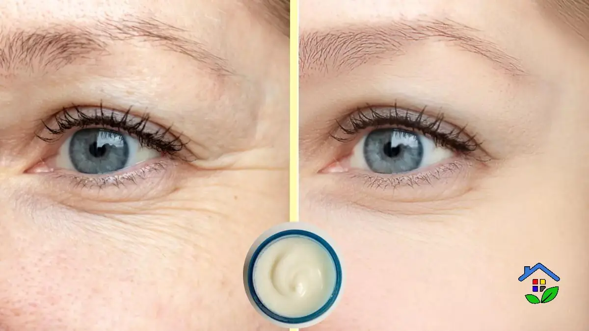 Botox Alternative: Natural Wrinkle Cream