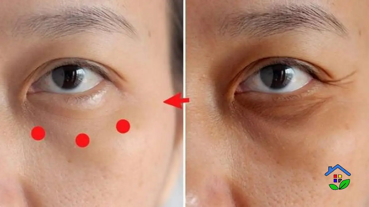 Revitalize Your Eye Contour with the Ancient Japanese Rejuvenation ...