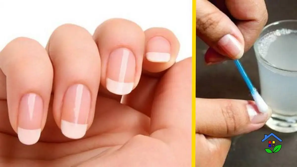 Stronger, Healthier Nails: 5 Tips to Prevent Breakage and Promote Growth